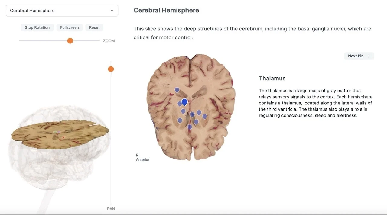 Neuroscience Education | Interactive Video Tools for Faculty | Clinical Pattern Recognition